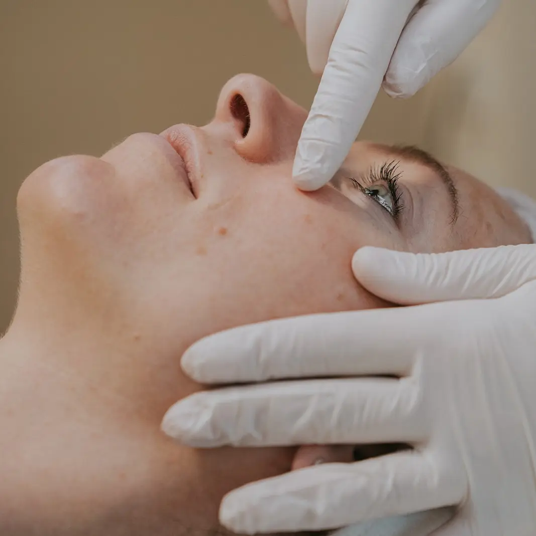 Huidproblemen - Skincare